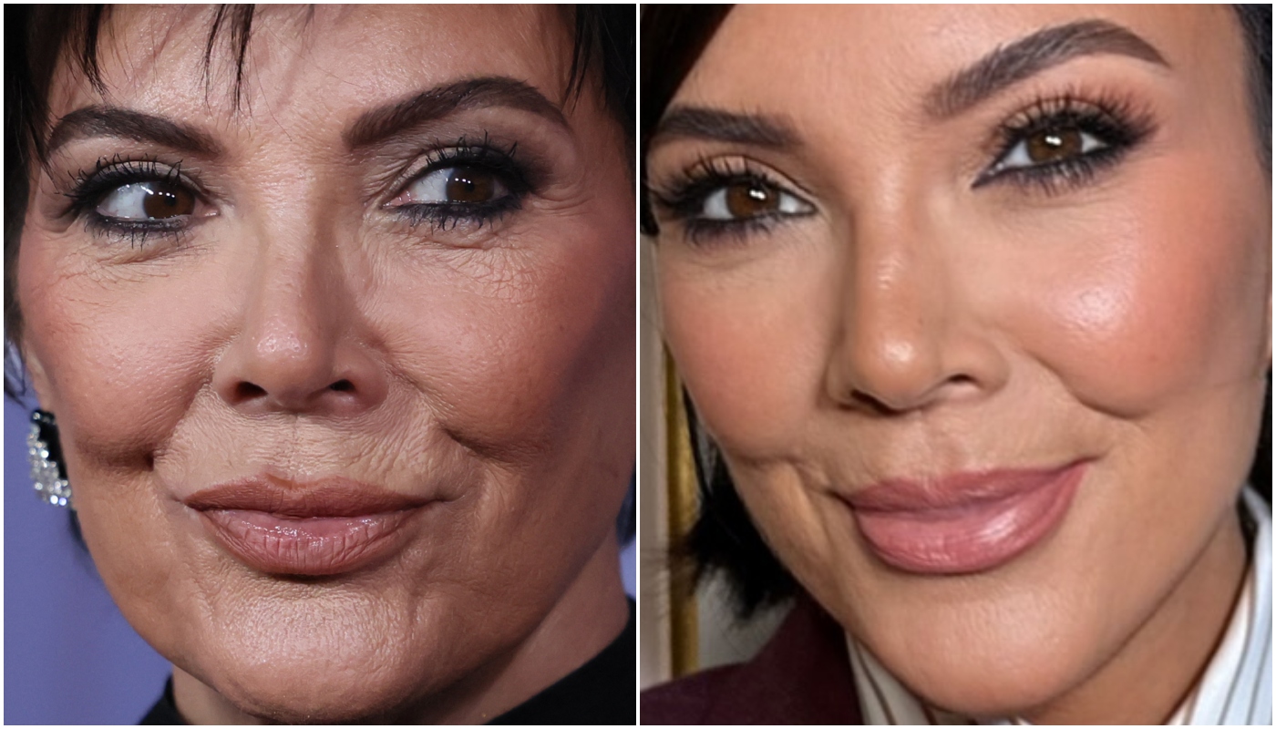 Antes e depois de Kris Jenner causa furor nas redes sociais - Zappeando