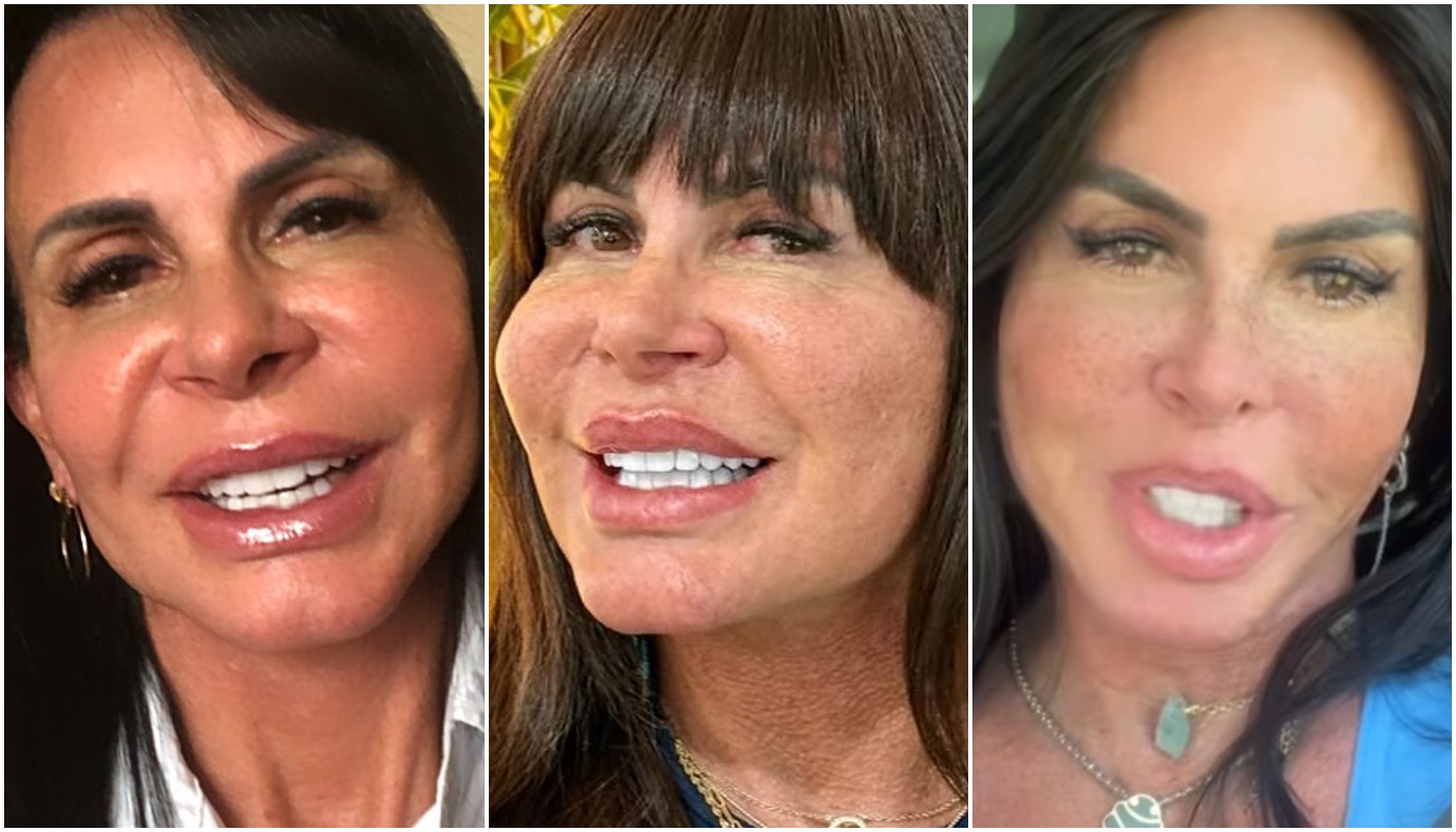 Gretchen muda formato de harmonização facial: fotos - Zappeando